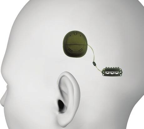 Hair Clip + Safety Line loop | Cochlear Denmark